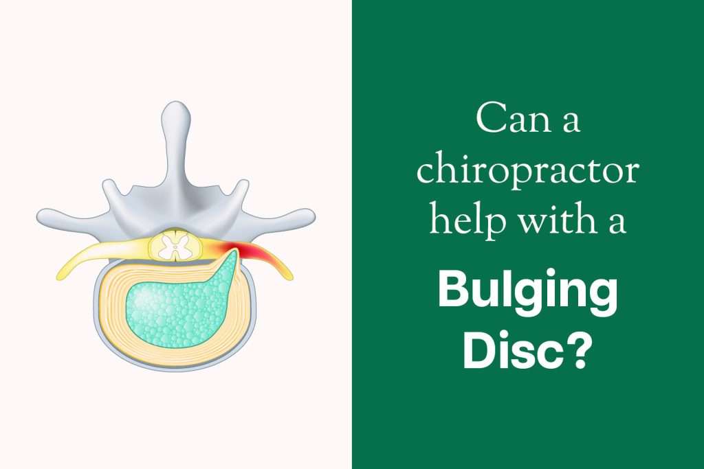 Can a Chiropractor Help with a Bulging Disc? • Copa Chiropractic Wales